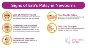 Erb's Palsy Symptoms | Birth Injury Center