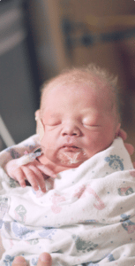 Birth Asphyxia | Birth Injury Center